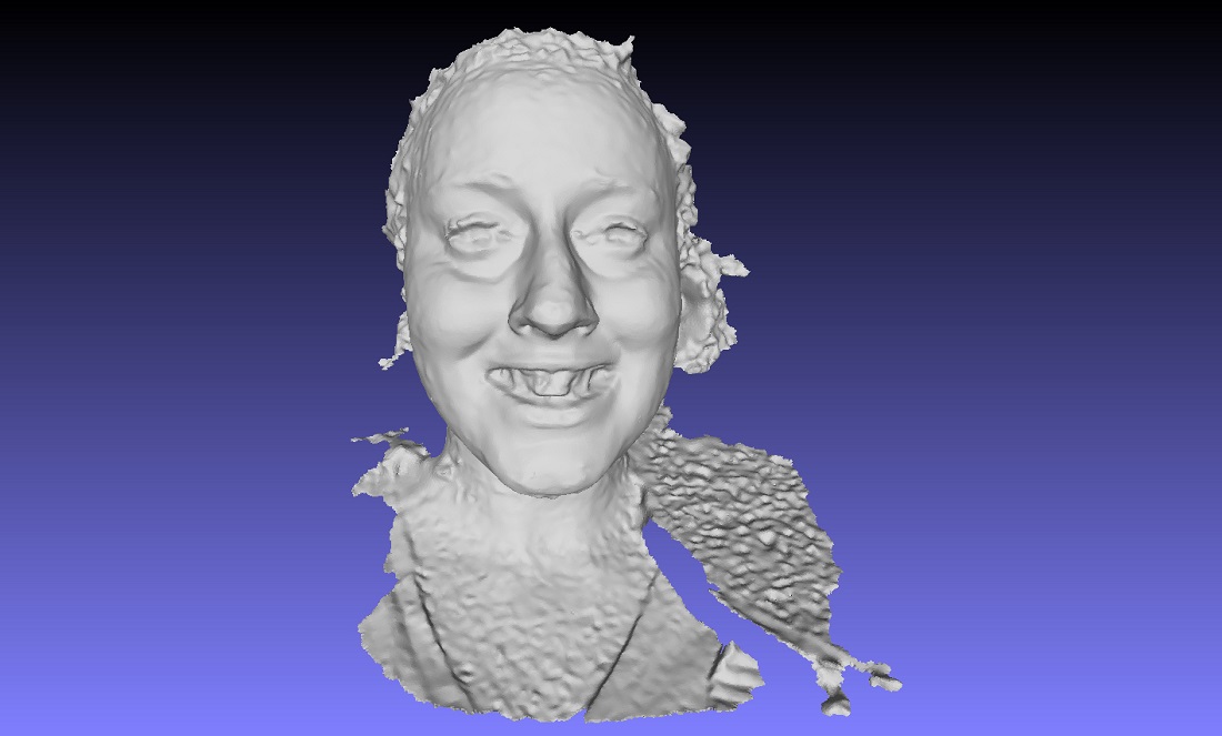 Sleep Apnoea Test & Sleep Apnoea Diagnosis | Particle