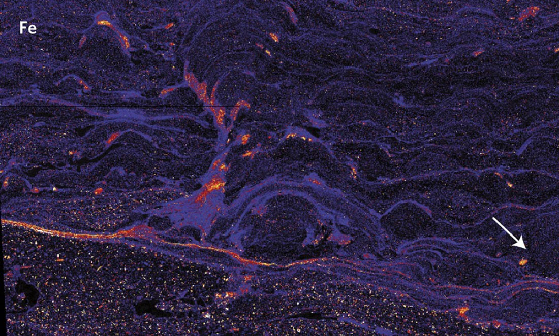 Can life exist without oxygen? - Earth news | Particle