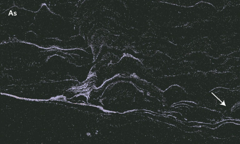 Can life exist without oxygen? - Earth news | Particle