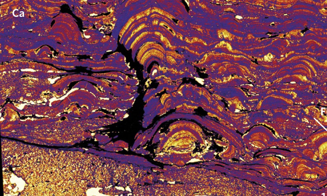 Can life exist without oxygen? - Earth news | Particle